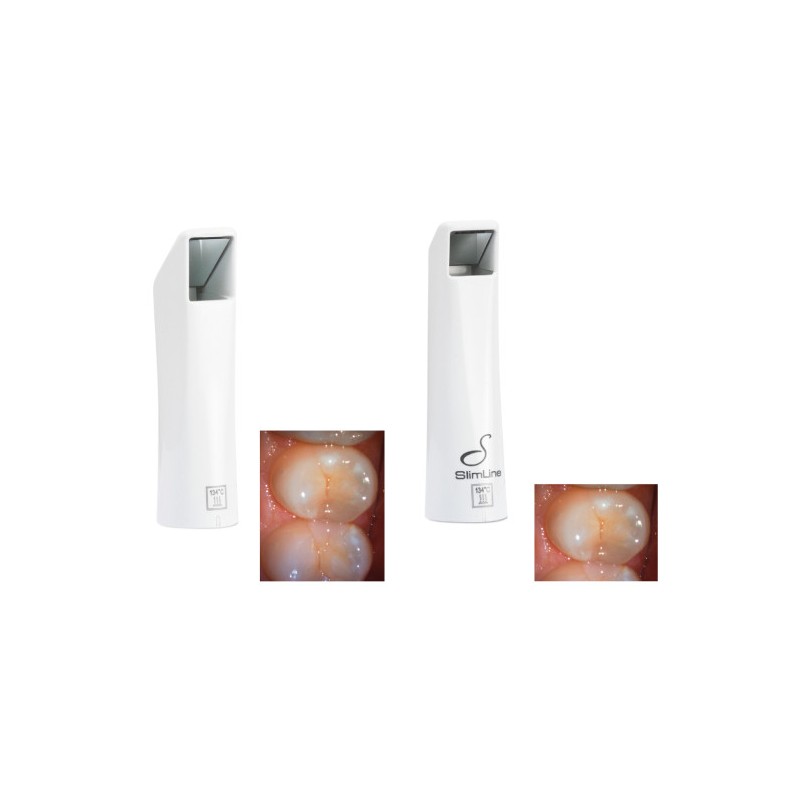 Scanner intraoral Proxam IOS, KaVo